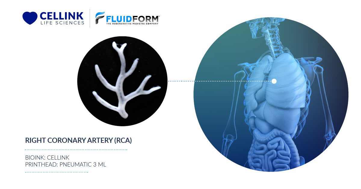 使用 FRESH 3D 生物打印实现更复杂的几何形状 - CELLINK China