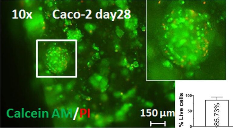 3D Bioprinted Colorectal Cancer Cells for Disease Modeling - CELLINK China